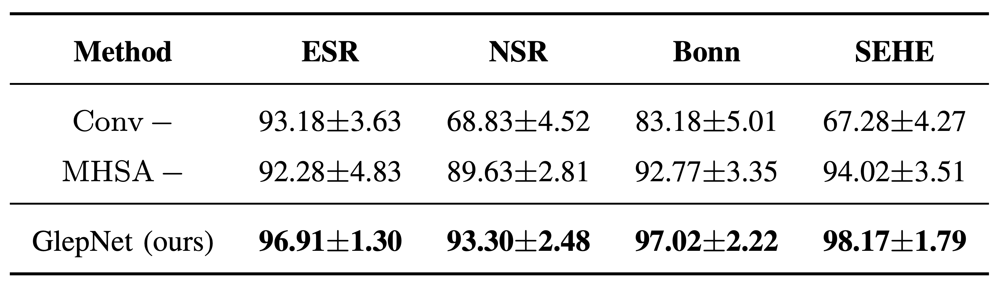 Learning Robust Global Local Representation From Eeg For Neural Epilepsy Detection